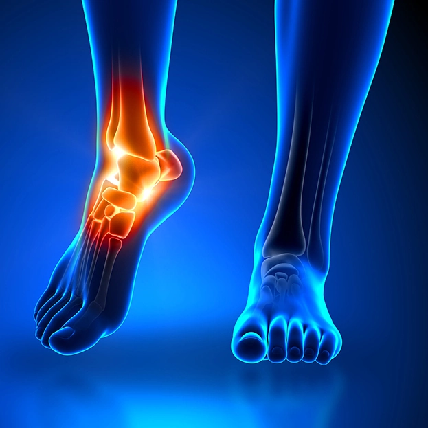Fußschmerzen: Die 5 häufigsten Ursachen | Beyond Imaging